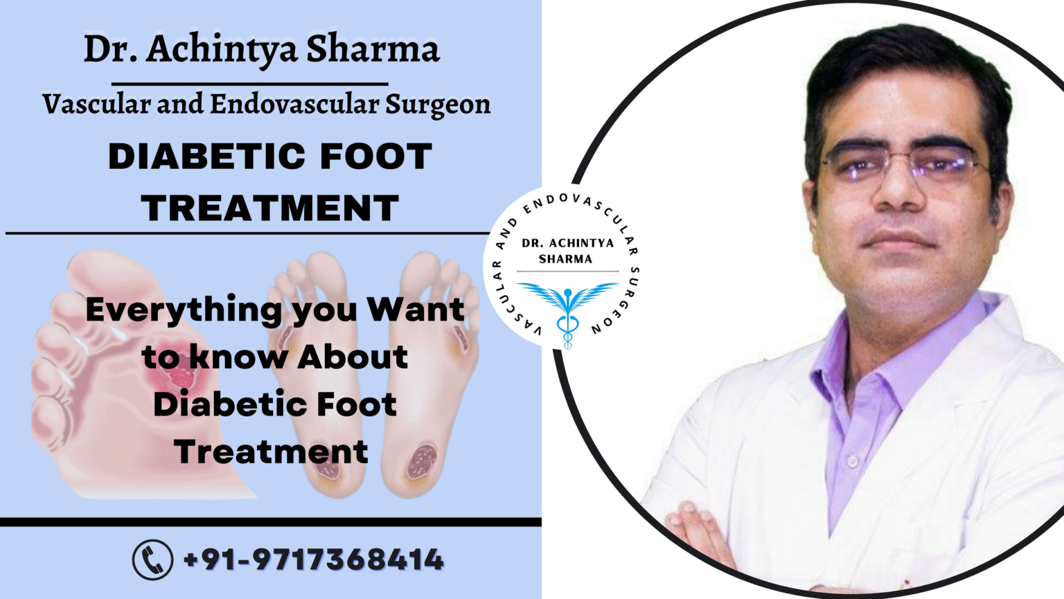 Diabetic Foot treatment | Dr. Achintya Sharma
