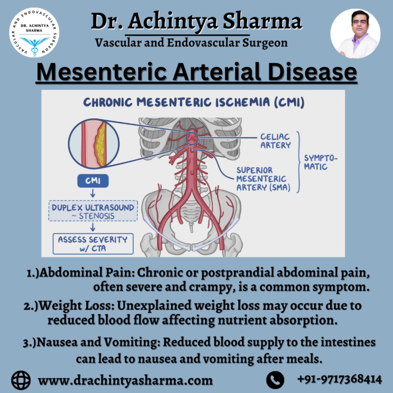 Needs to understand about Mesenteric Artery Disease Symptoms