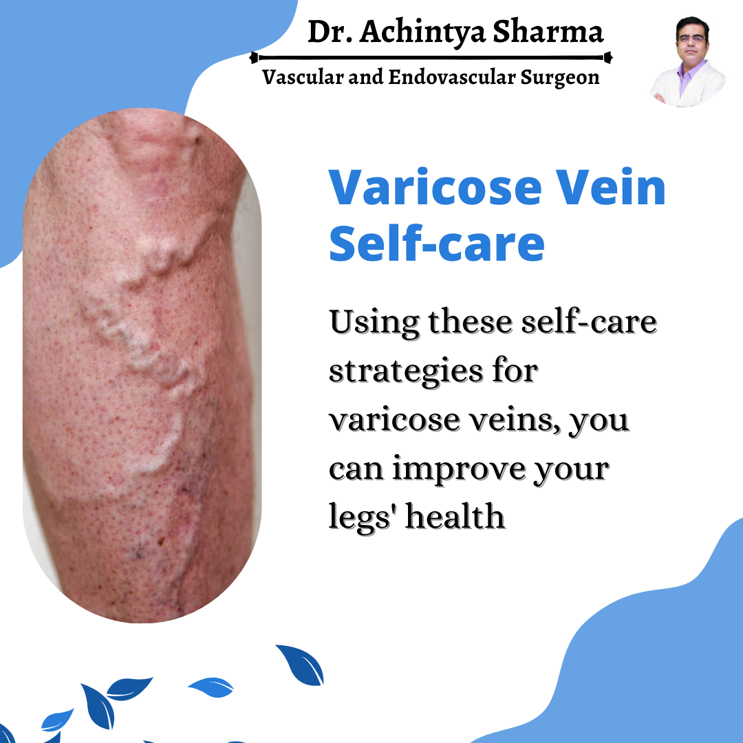 Ways to Care, Happier Life Despite varicose veins self-care.