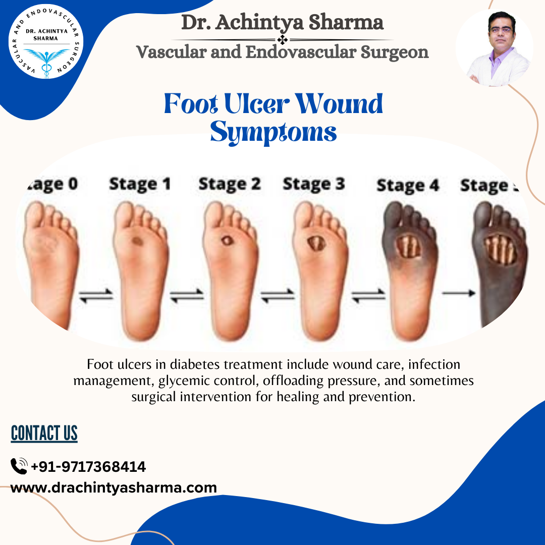 The Future of Healing Foot Ulcers in Diabetes Treatment