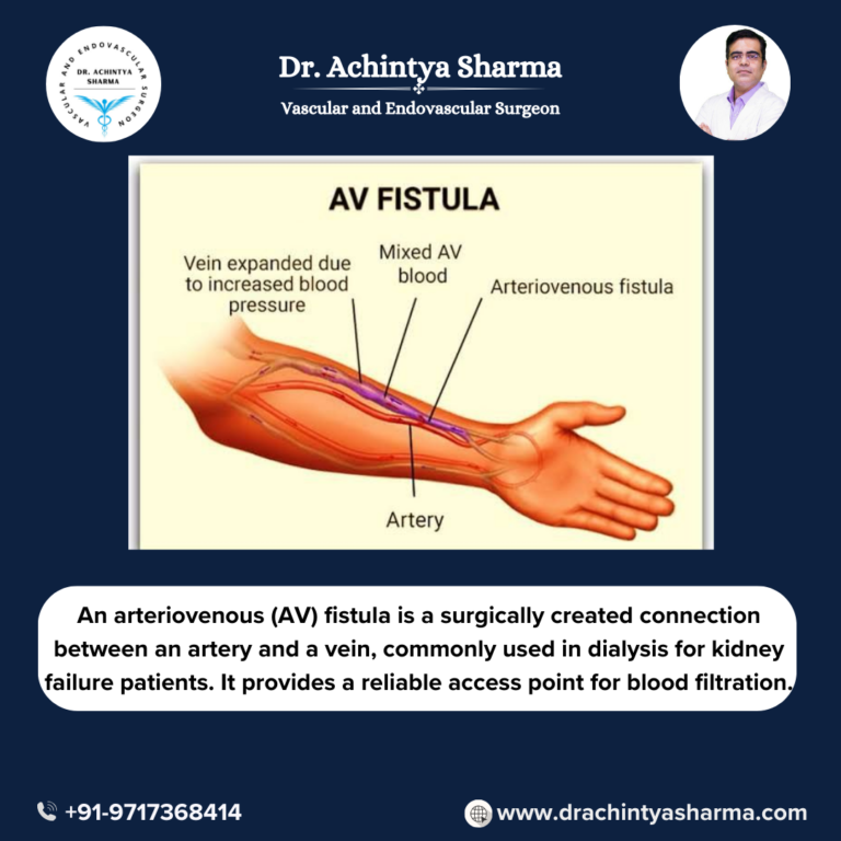 Understanding Fistula Surgery for Dialysis: Guiding Principles