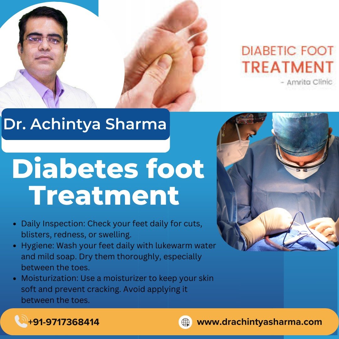 "Innovative Approaches to Diabetes Ulcer Treatment" - Dr.Achintya Sharma