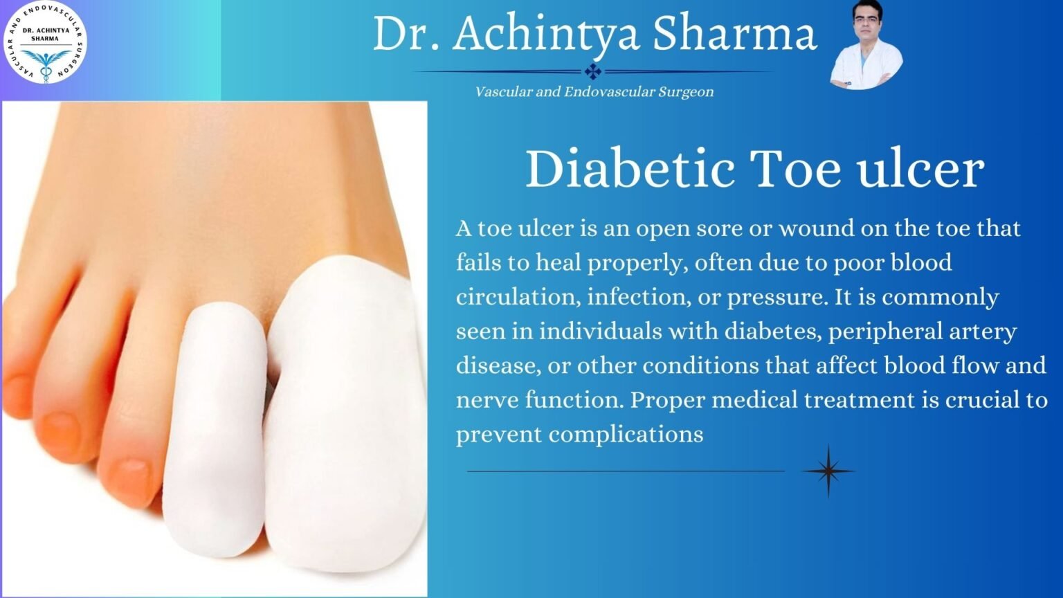 Diabetes Foot Care: Treating and Preventing Ulcers on the Toe