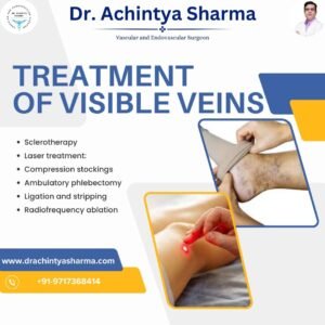 Visible Veins on Legs: Causes, Symptoms, and Treatments