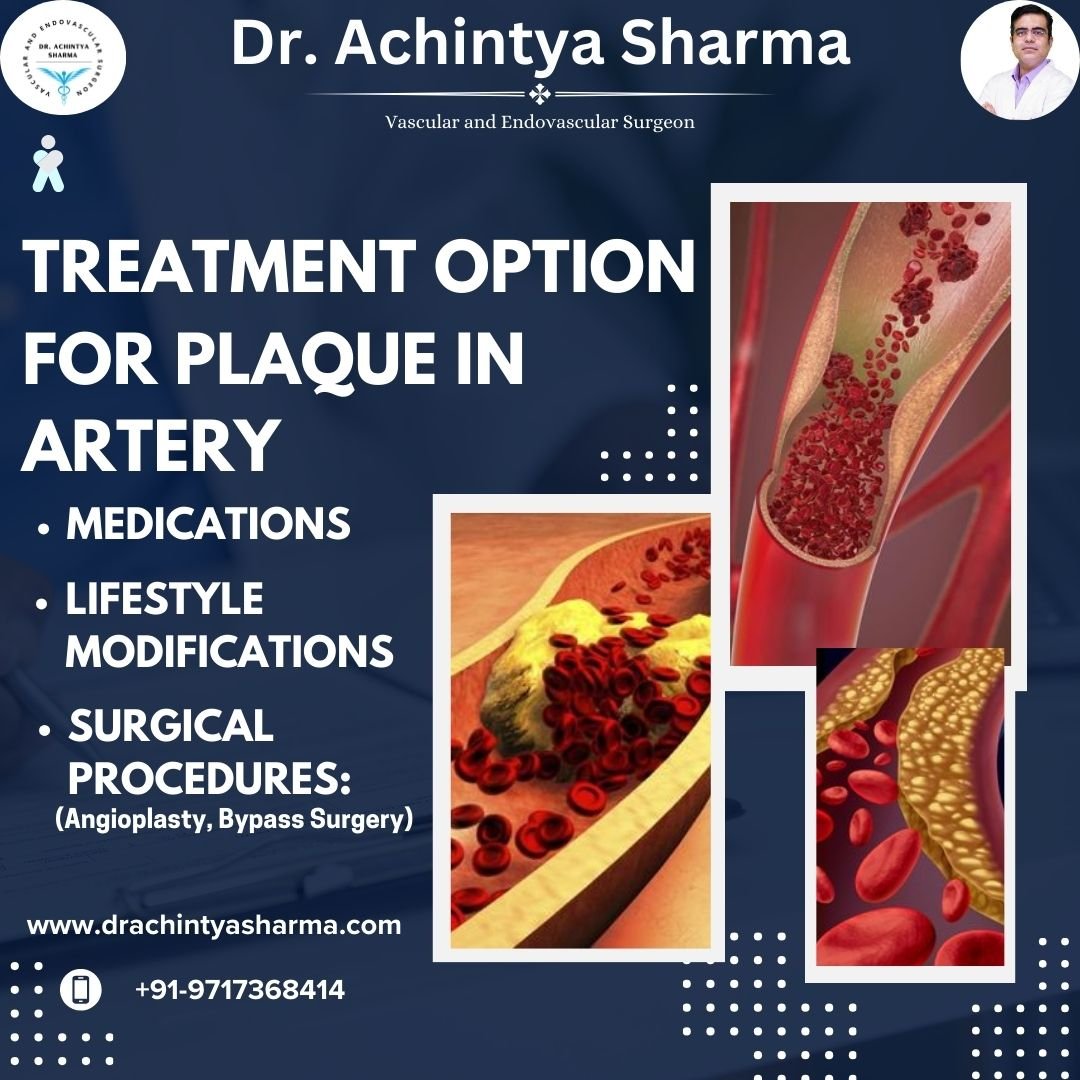 Plaque in Arteries: Symptoms and Treatment