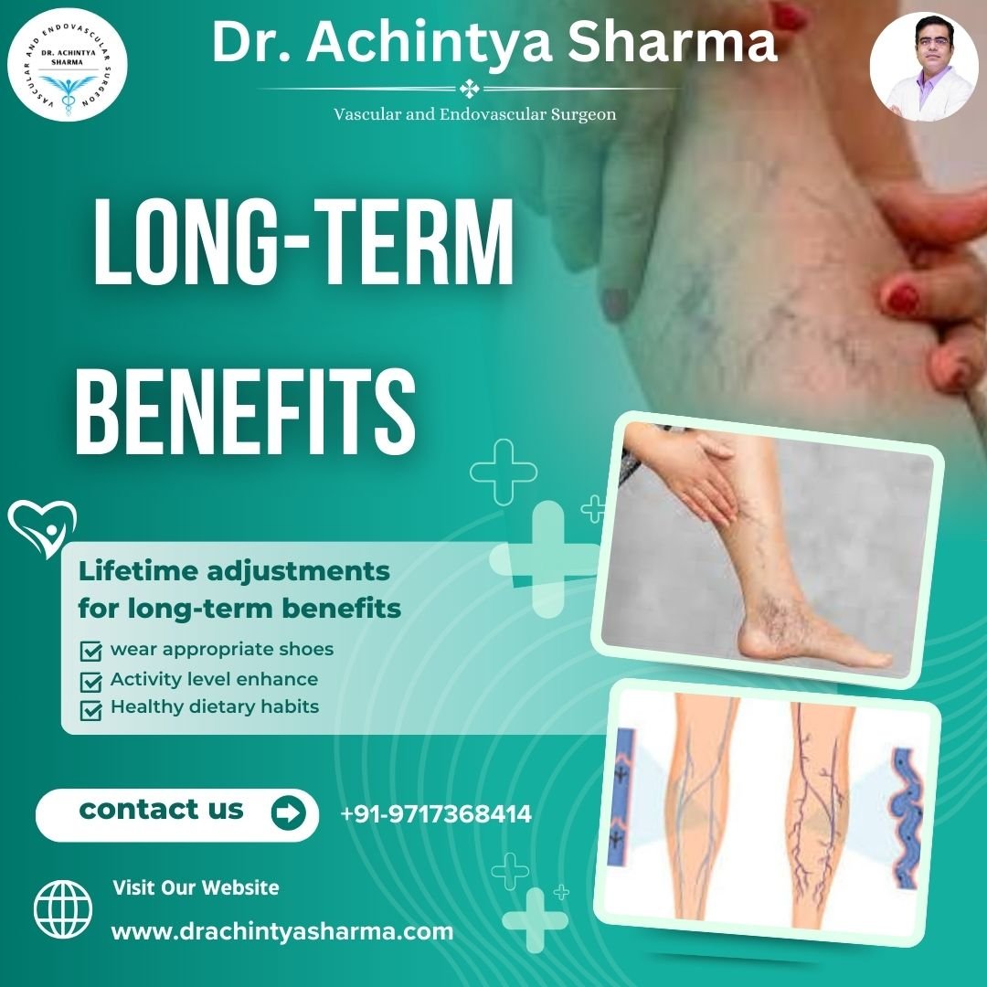 Effective Varicose Veins Self-Care Tips for Better Vein Health