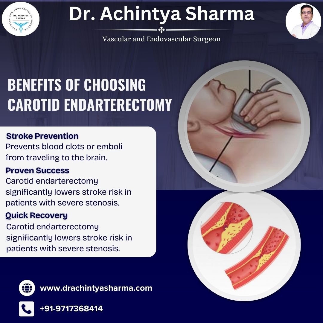 "Carotid Endarterectomy: Prevent Stroke & Improve Blood Flow"