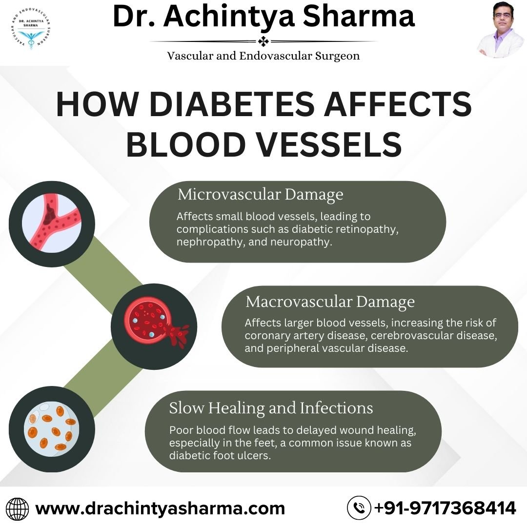 How Vascular Illness Starts with Diabetes | Dr. Achintya Sharma