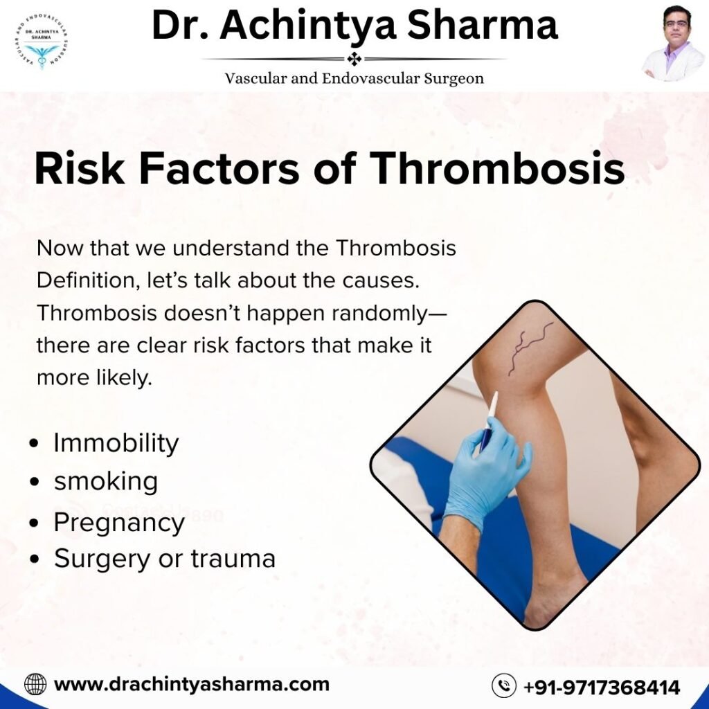 Understanding Thrombosis Definition and Risk Factors - Dr.Achintya Sharma